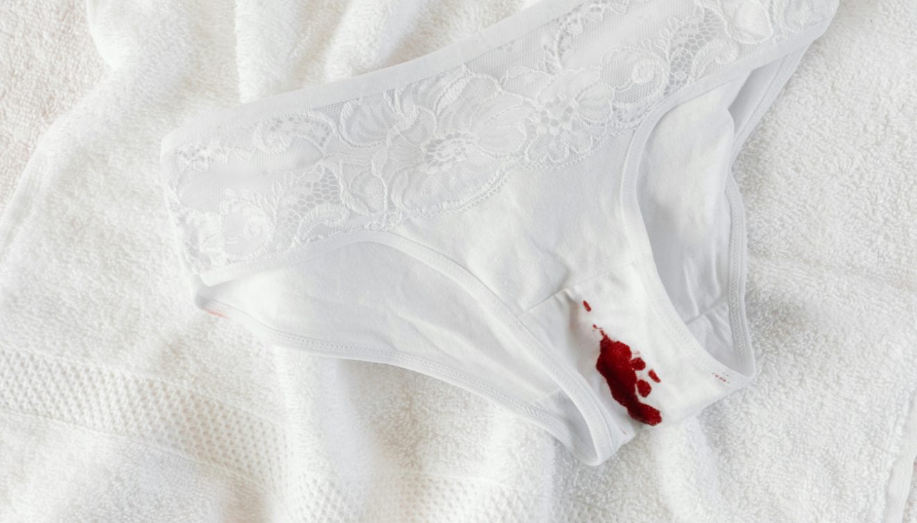 Saignement pendant l'ovulation (métrorragie ) : Définition